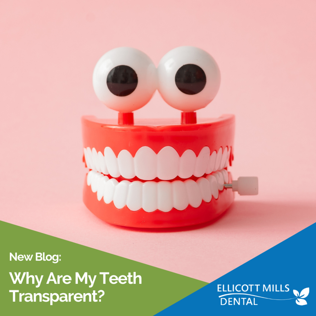 Why Are My Teeth Transparent? - Ellicott Mills Dental