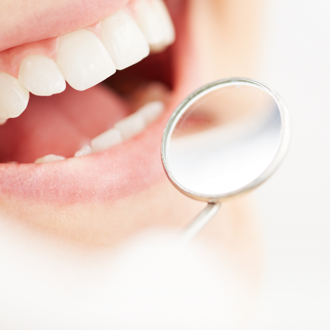 Why Are My Teeth Transparent? - Ellicott Mills Dental